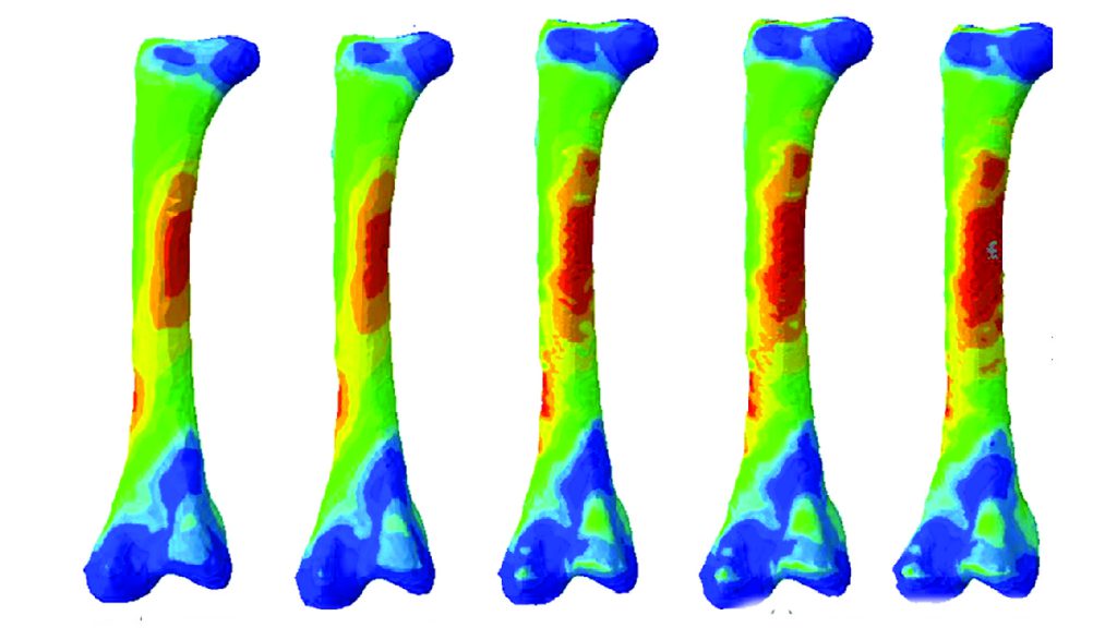 Biomechanical Engineering of Human Bones and the aftermath of Covid-19 ...