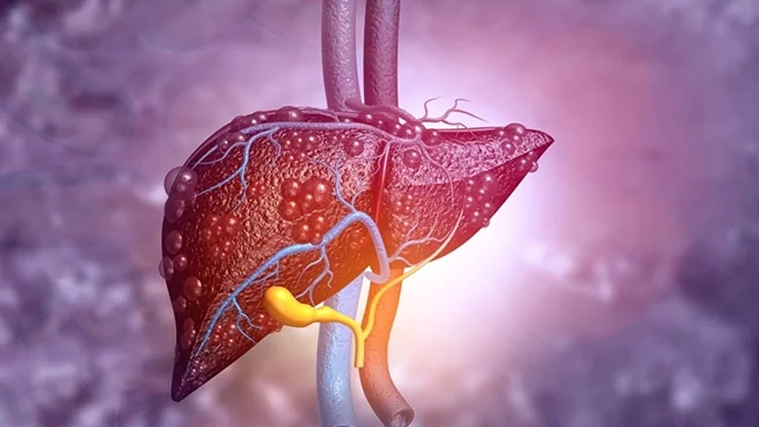 Unveiling the Link Between Genetic Variations and Liver Cancer ...