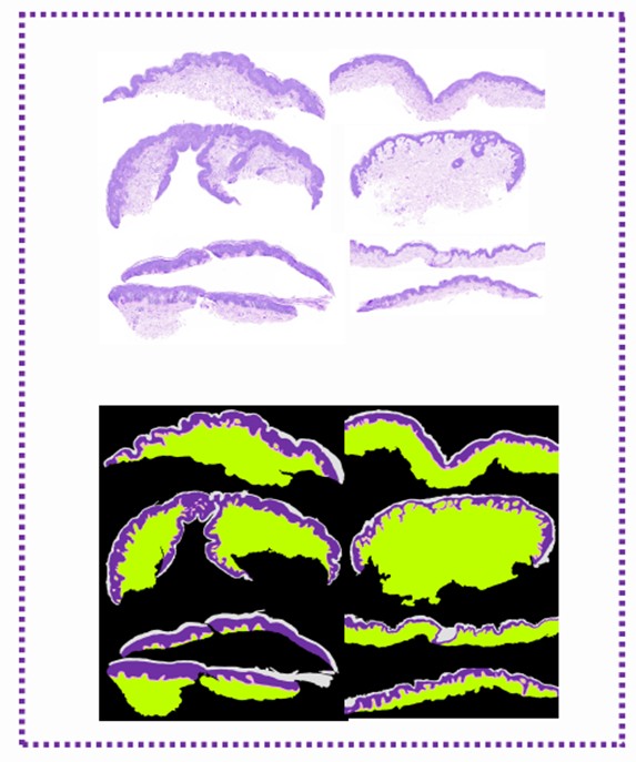 DERMA-PRUNED: AI for Smarter Skin Diagnosis - Research at NUST